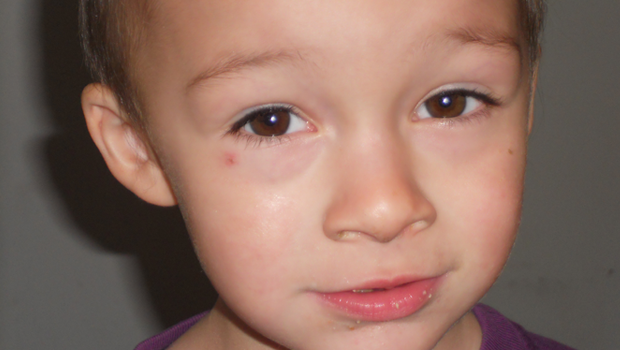 Dyade autistique - Blog Hop'Toys